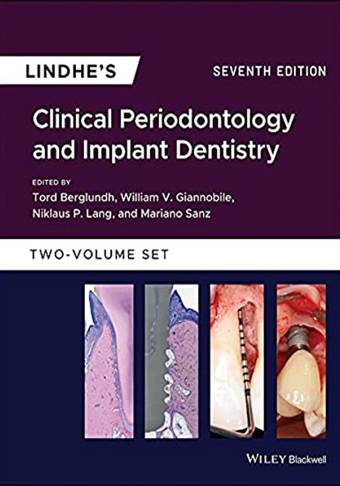 Lindhe's Clinical Periodontology and Implant Dentistry – Classic ...